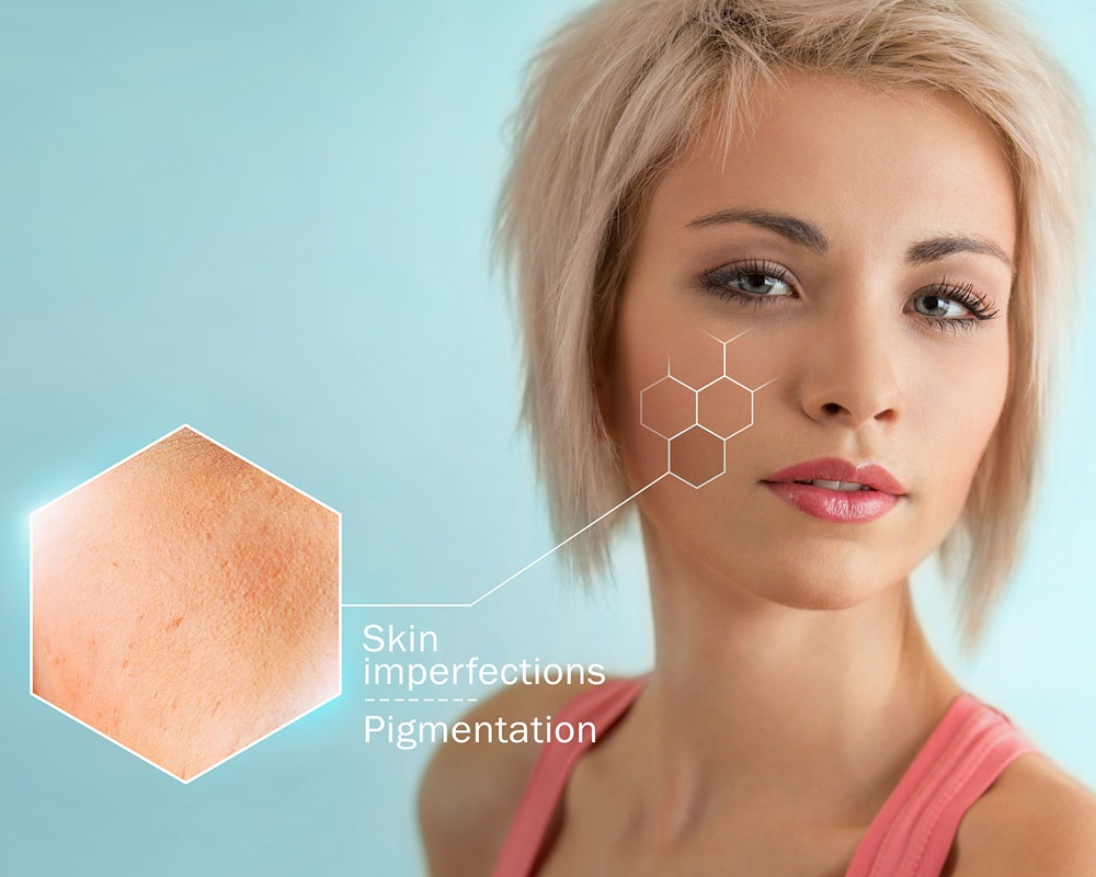 ☀ Pigmentflecken - Behandlung in Frankfurt